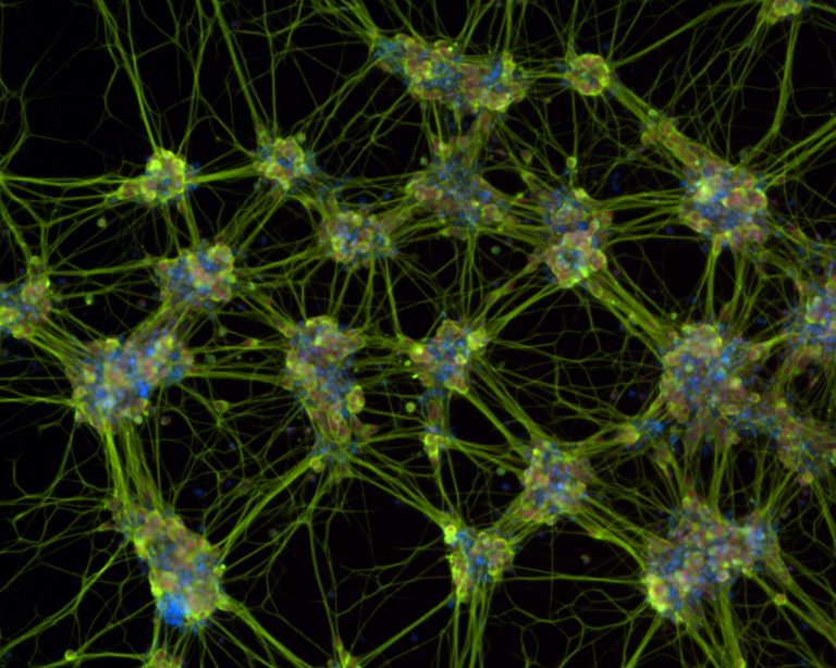 Motor neurons – Zakian Lab iPSC collection