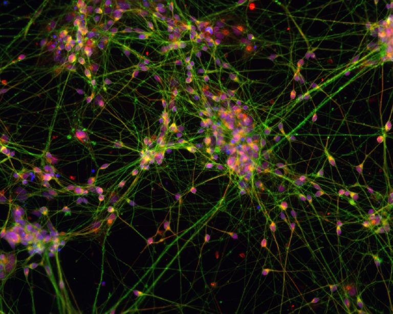 Medium spiny neurons – Zakian Lab iPSC collection